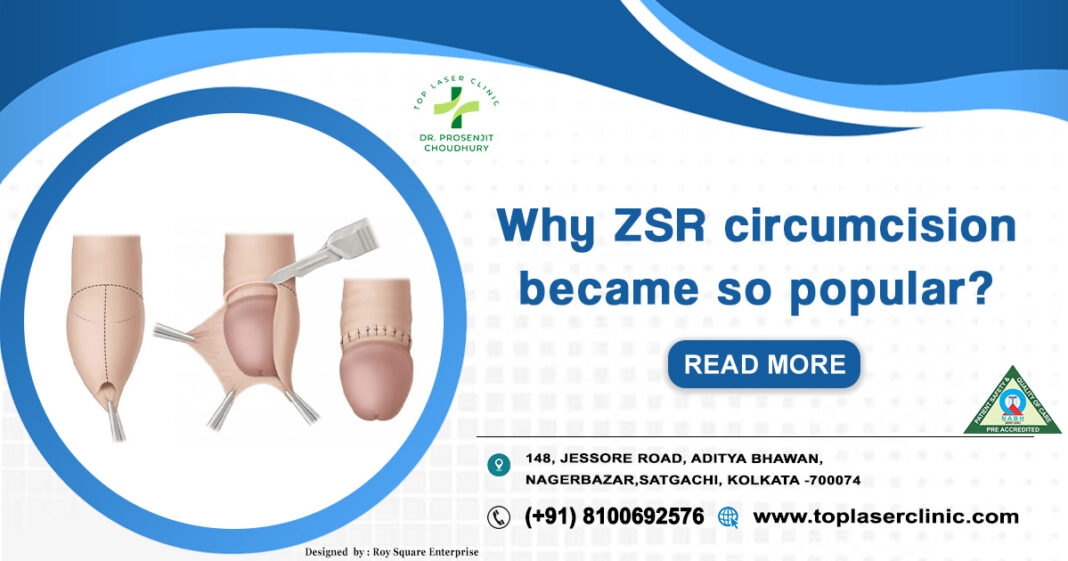 ZSR Circumcision: A Painless Process