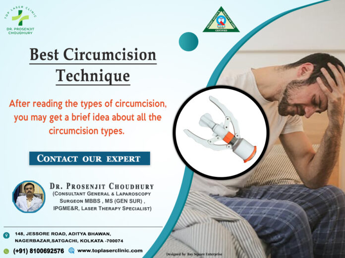 Circumcision Techniques: A Comprehensive Guide to Different Types
