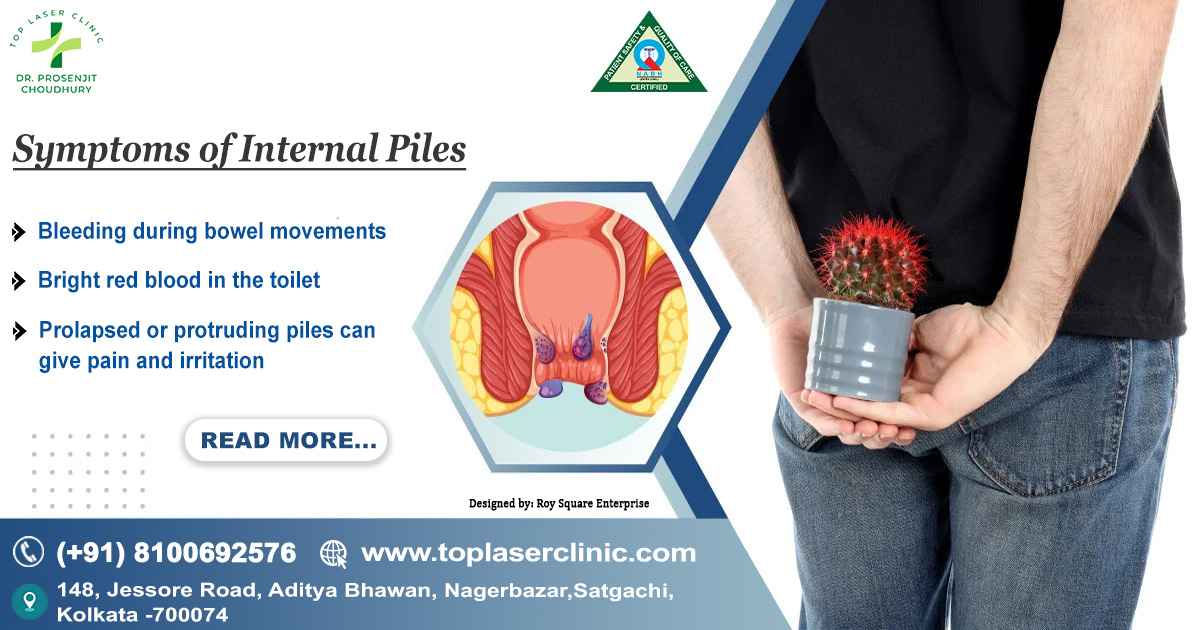 Different Types of Piles: Symptoms, Causes & Treatment