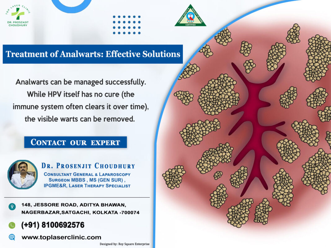 Anal Warts: Symptoms, Causes & Treatment Guide