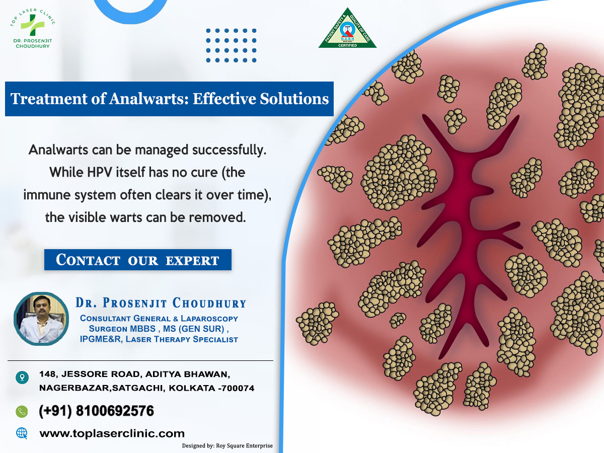 Anal Warts: Symptoms, Causes & Treatment Guide